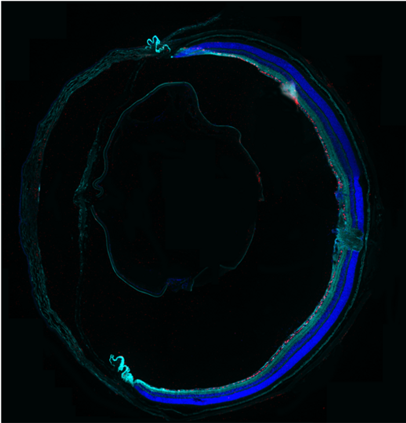 Multiple mutations may no longer stump gene therapies | Drug Discovery News
