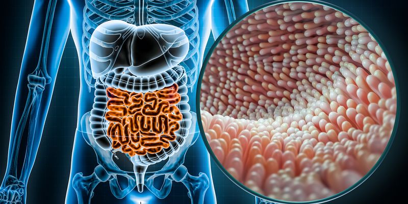 Taming the immune response to gluten to treat celiac disease | Drug ...