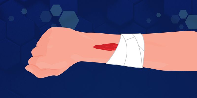 The cellular players that enable wound healing | Drug Discovery News