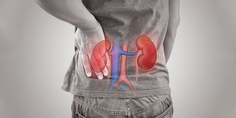 New tools for detecting kidney transplant rejection | Drug Discovery News