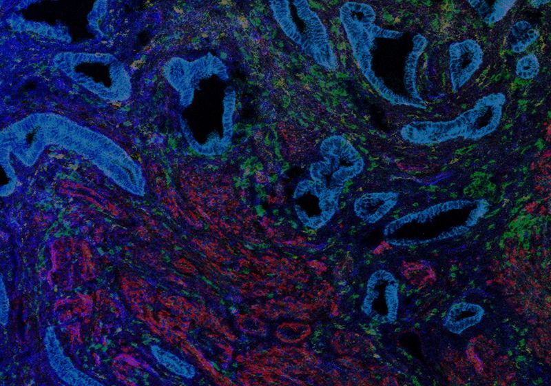 Science Milestone: The development of imaging mass cytometry | Drug ...