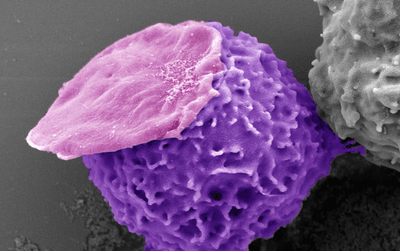 Neutrophil backpacks for cancer immunotherapy | Drug Discovery News