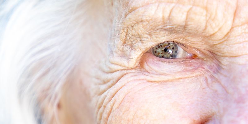 Eleva publishes evidence of immunomodulation and neuroprotection using ...