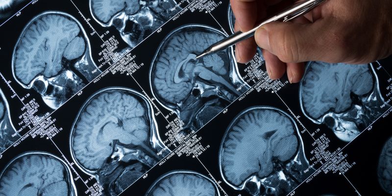 Enhanced Genomics and The ALBORADA Drug Discovery Institute partner to accelerate Alzheimer's ...