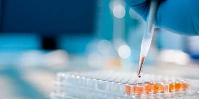 Precision Quantomics Inc. awarded NIH grant to develop recombinant human enzyme kits for ...