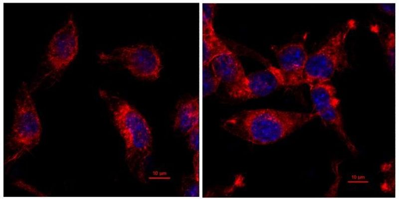Novel strategies to boost immune checkpoint inhibitor drugs | Drug ...
