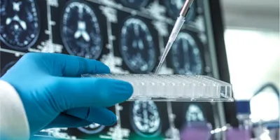 Why toxicology is still the toughest test for NAM adoption | Drug ...